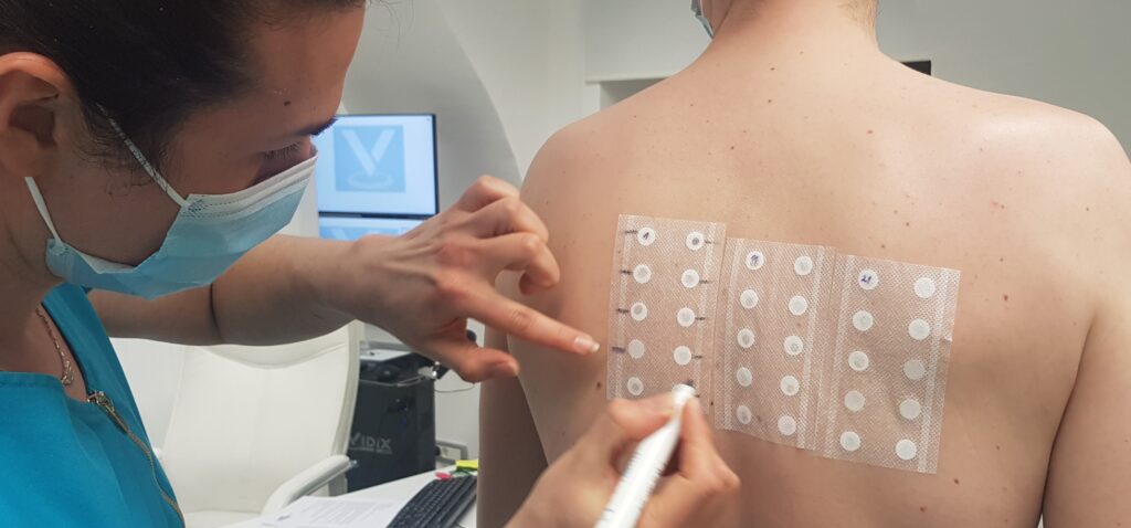 Diagnostic Allergy testing - Clynic DermaPlus Zagreb